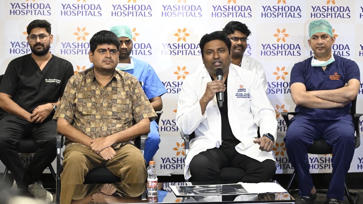 Talus bone implant made of titanium used in joint replacement surgery ...