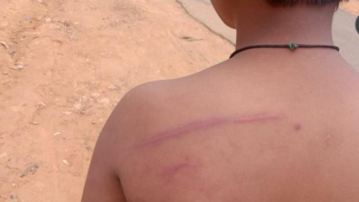 Child returns home with bruises after punishment by teacher in ...