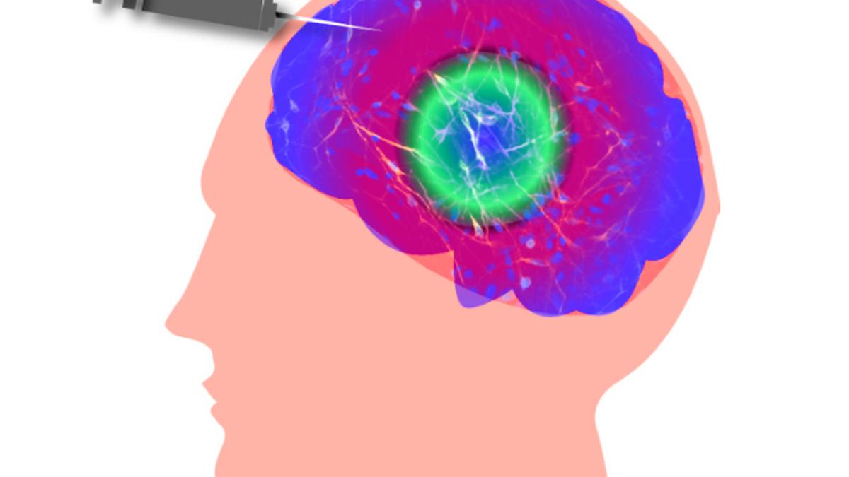 Scientists restore youthful vigour to adult brains - The Hindu