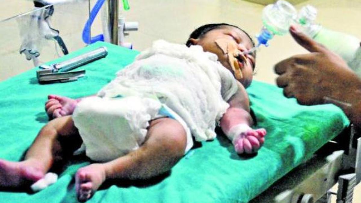 Braveheart baby dies after 15-hour ordeal - The Hindu