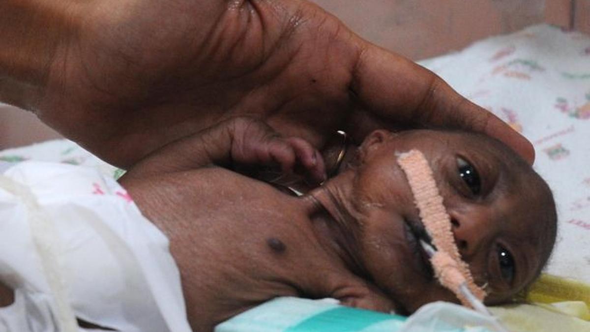 Mumbai hospital helps 16-day-old baby with rare disorder - The Hindu