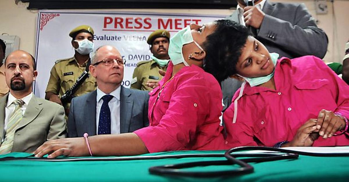 Conjoined twins, Veena and Vani, see a glimmer of hope - The Hindu