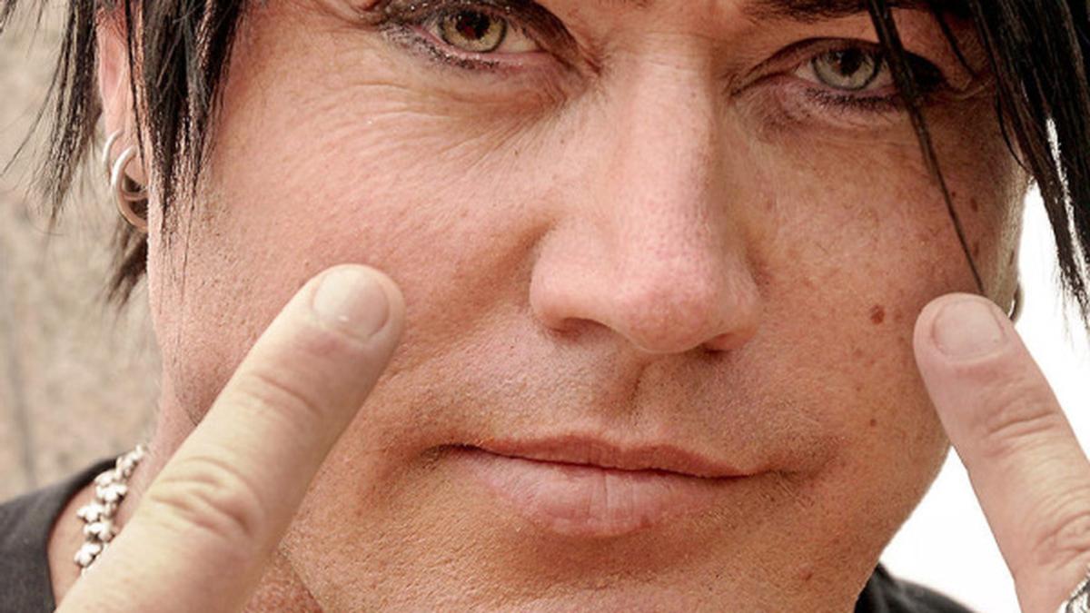 American singer changes iris colour through implant - The Hindu