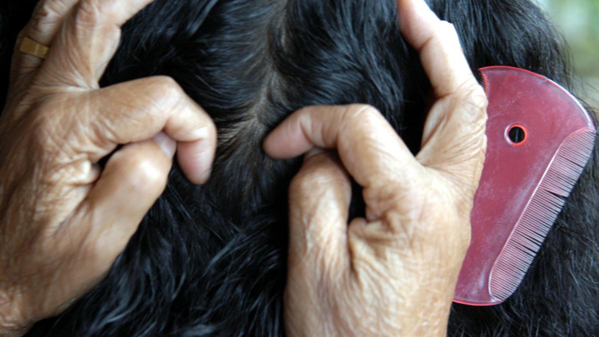 Lice genes evolved faster than those of human, chimp - The Hindu