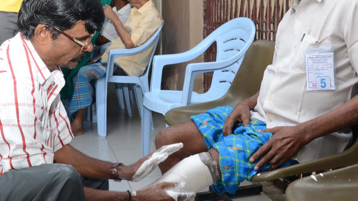 Artificial limbs bring them back on their feet - The Hindu