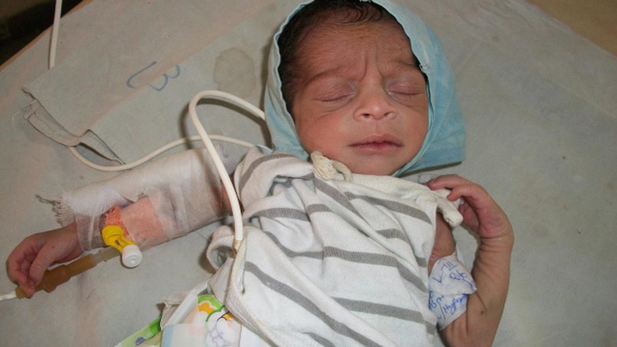 Infant with diabetes gets a lifeline - The Hindu