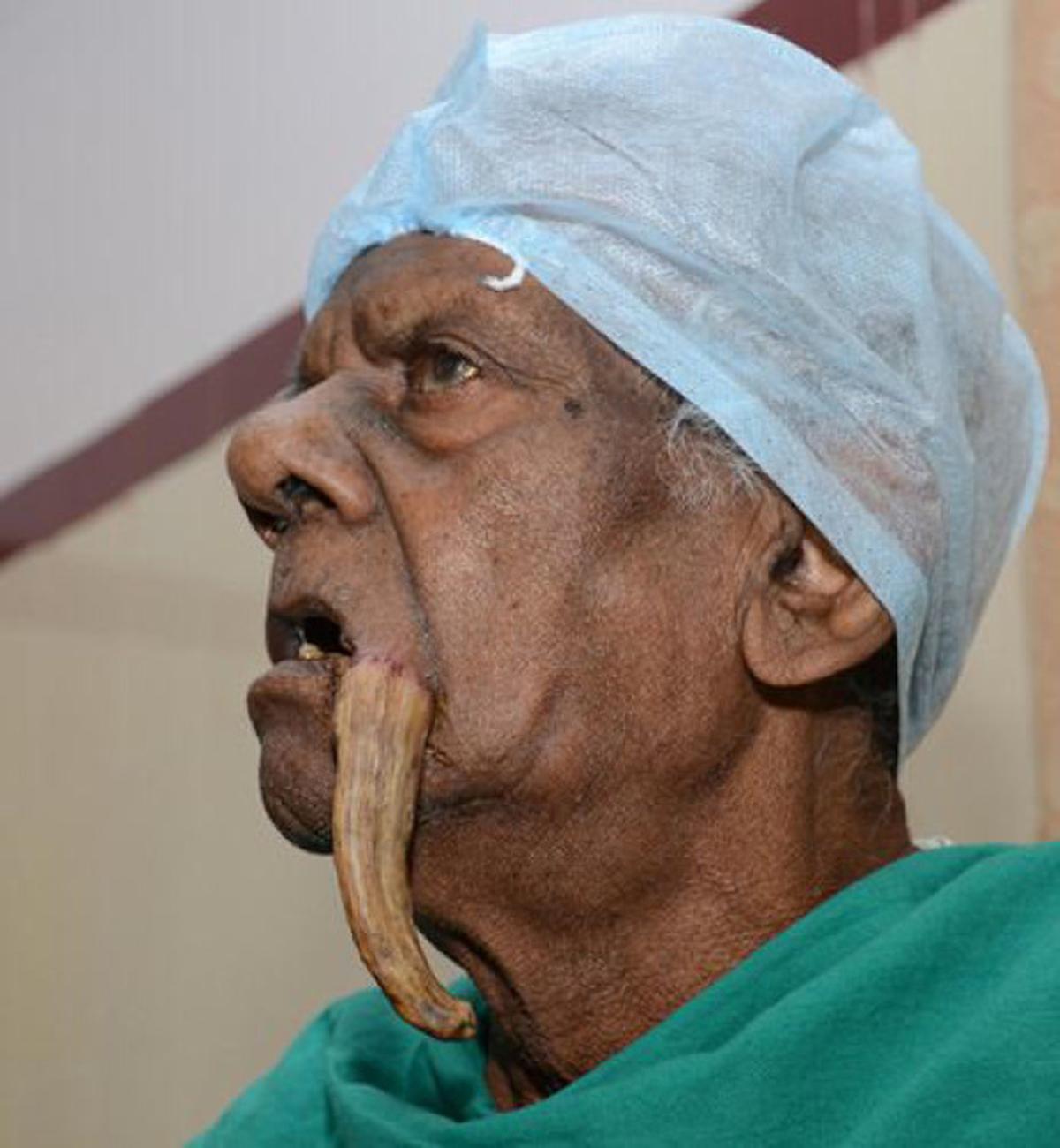 Reconstructive surgery reforms man's face - The Hindu