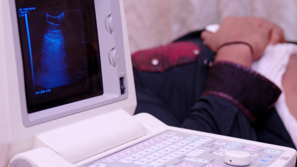 Supreme Court axes 51-year-old curb, single women get equal abortion ...