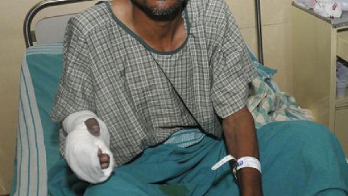 Bear attack victim survives to tell the tale, to be discharged soon ...