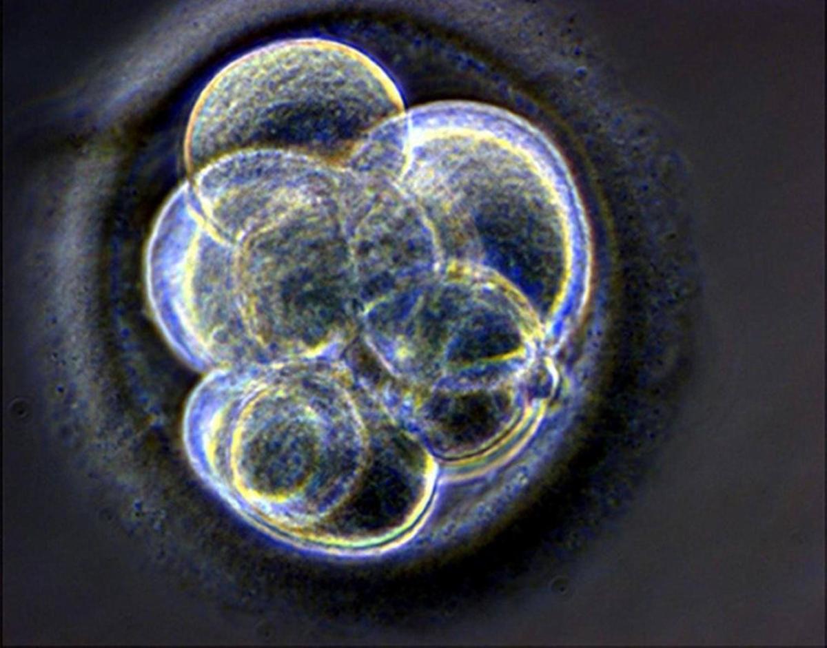Fertilized Human Egg
