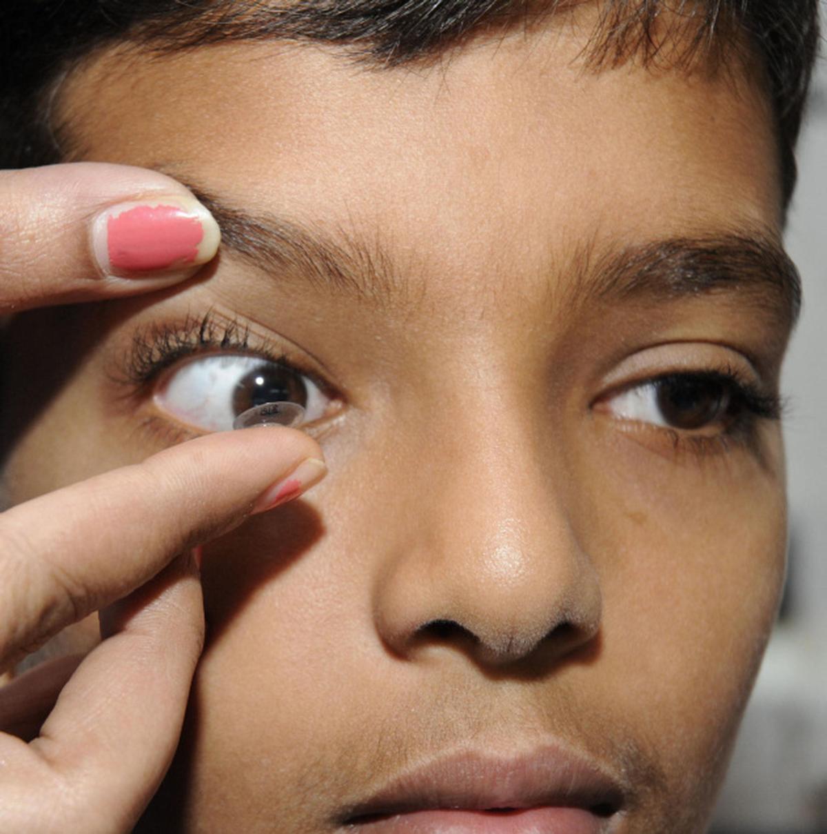 How overnight corrective lenses lend clear vision - The Hindu