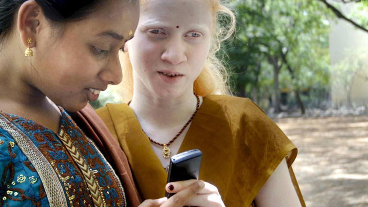 Their success dwarfs disability - The Hindu