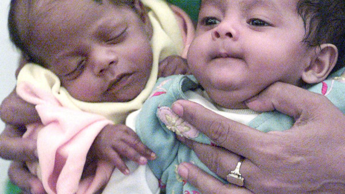 The genetics behind fraternal twinning - The Hindu