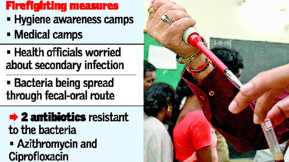 Typhoid strain lays many low - The Hindu