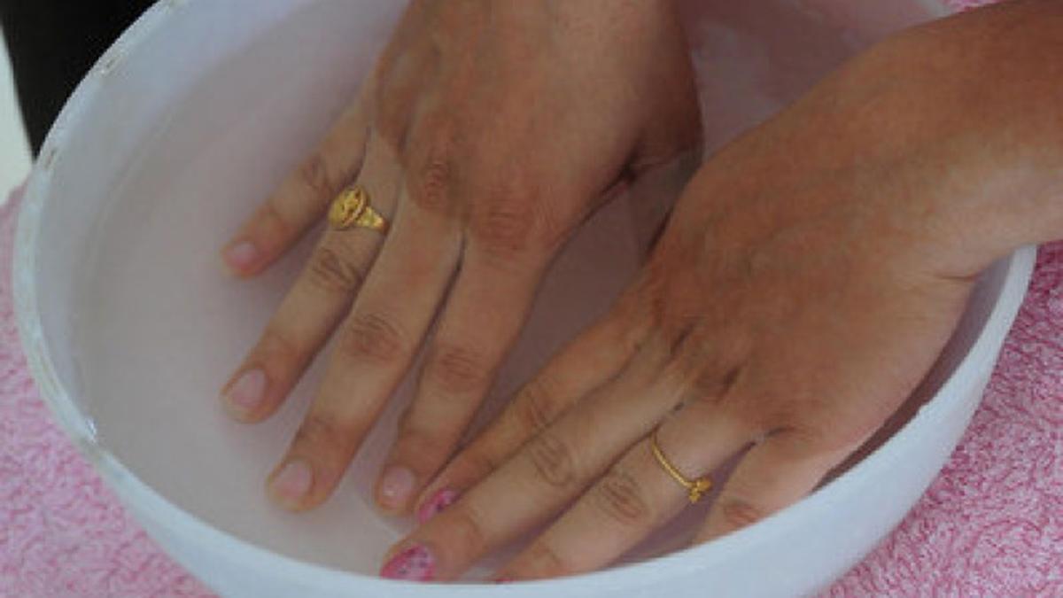 How to get rid of those palm calluses? - The Hindu