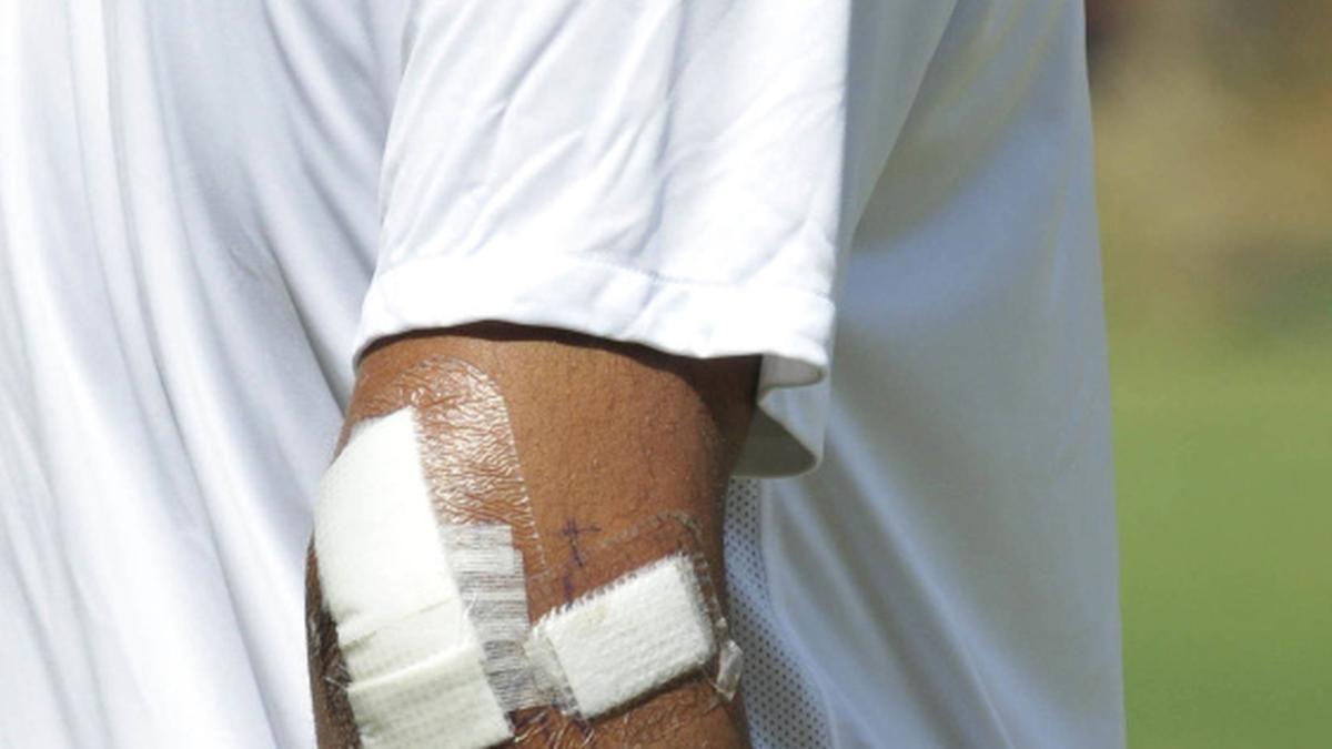 This scar won't go away - The Hindu