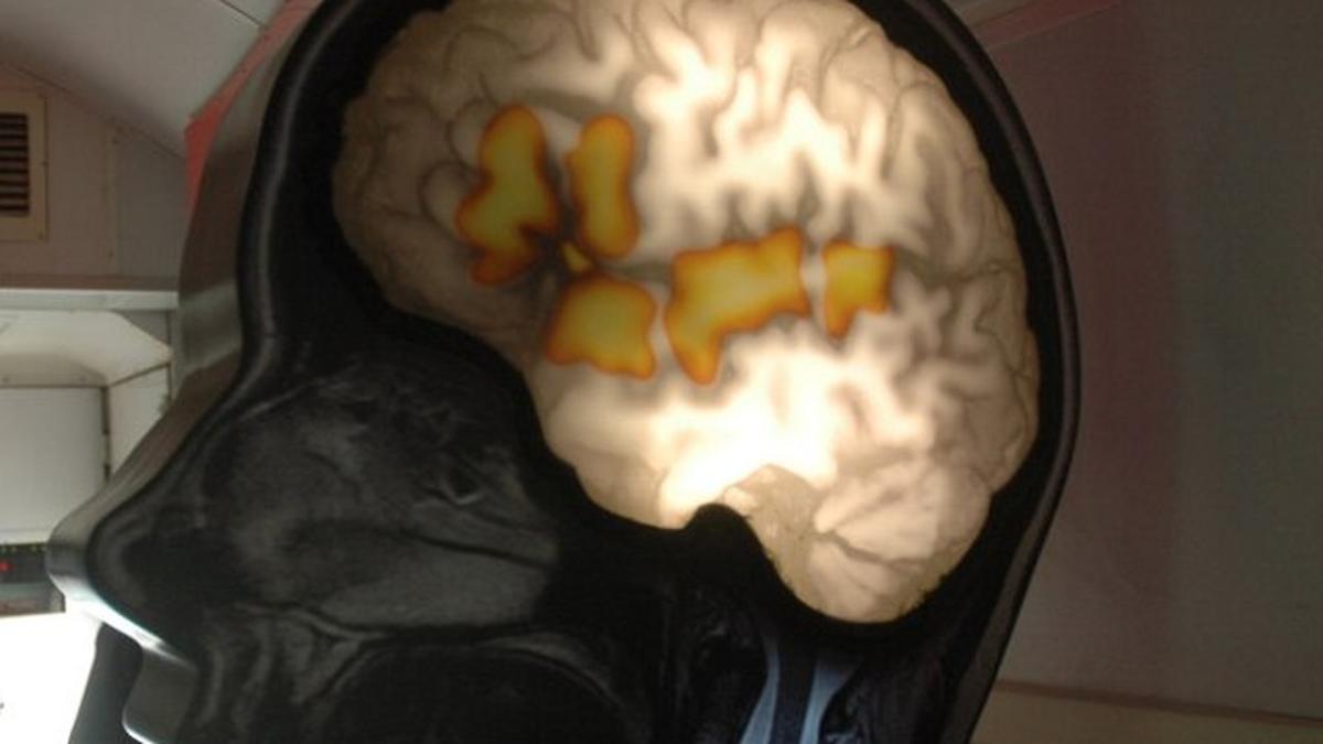 India needs to talk about mental illness - The Hindu