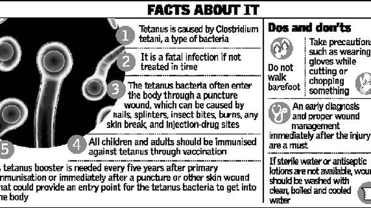 Tetanus, though preventable, still prevalent in Karnataka - The Hindu