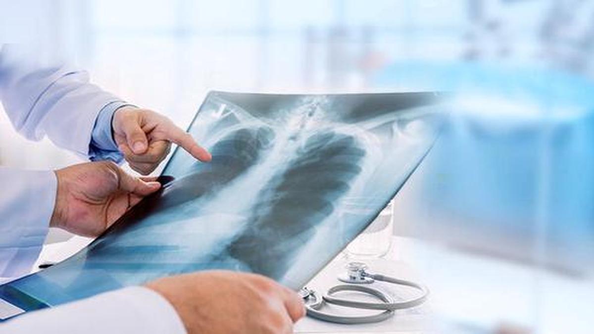 COPD, if left untreated, can affect other organs: expert - The Hindu