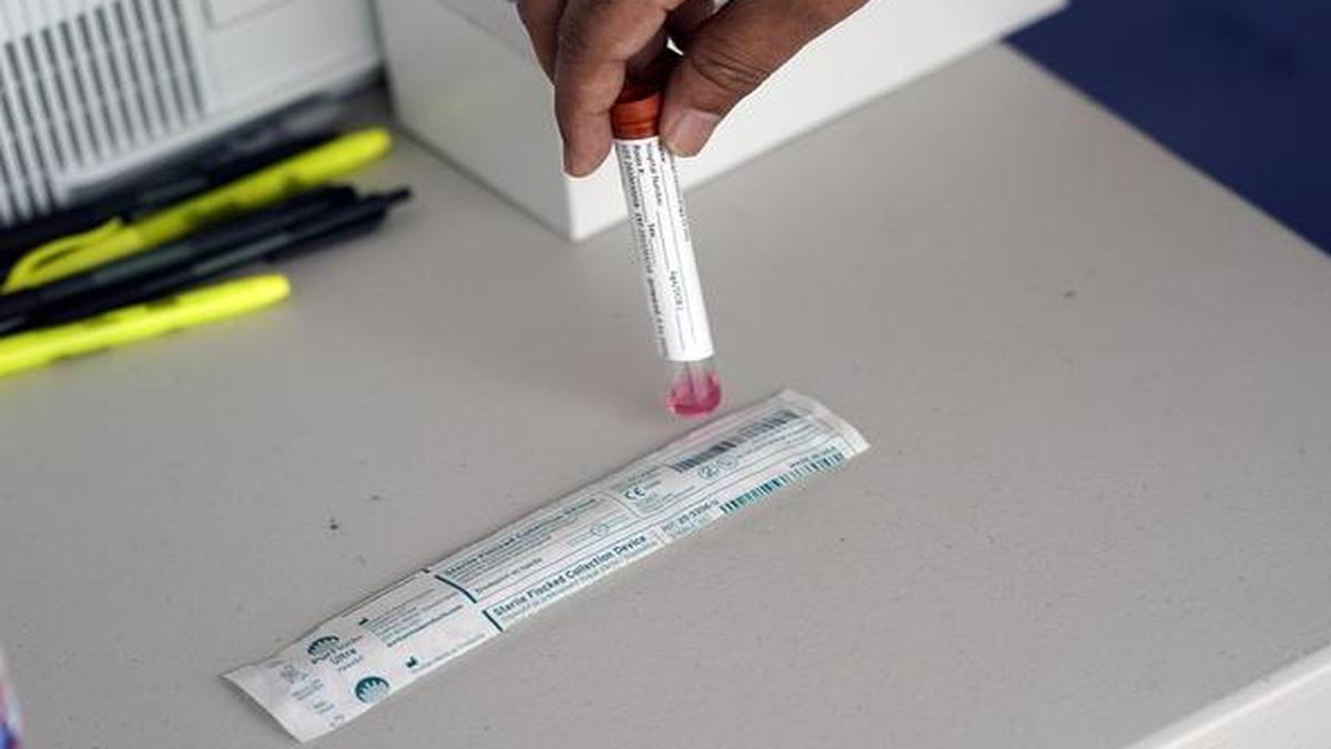 COVID -19 | Testing, treatment now available for free under Ayushman ...