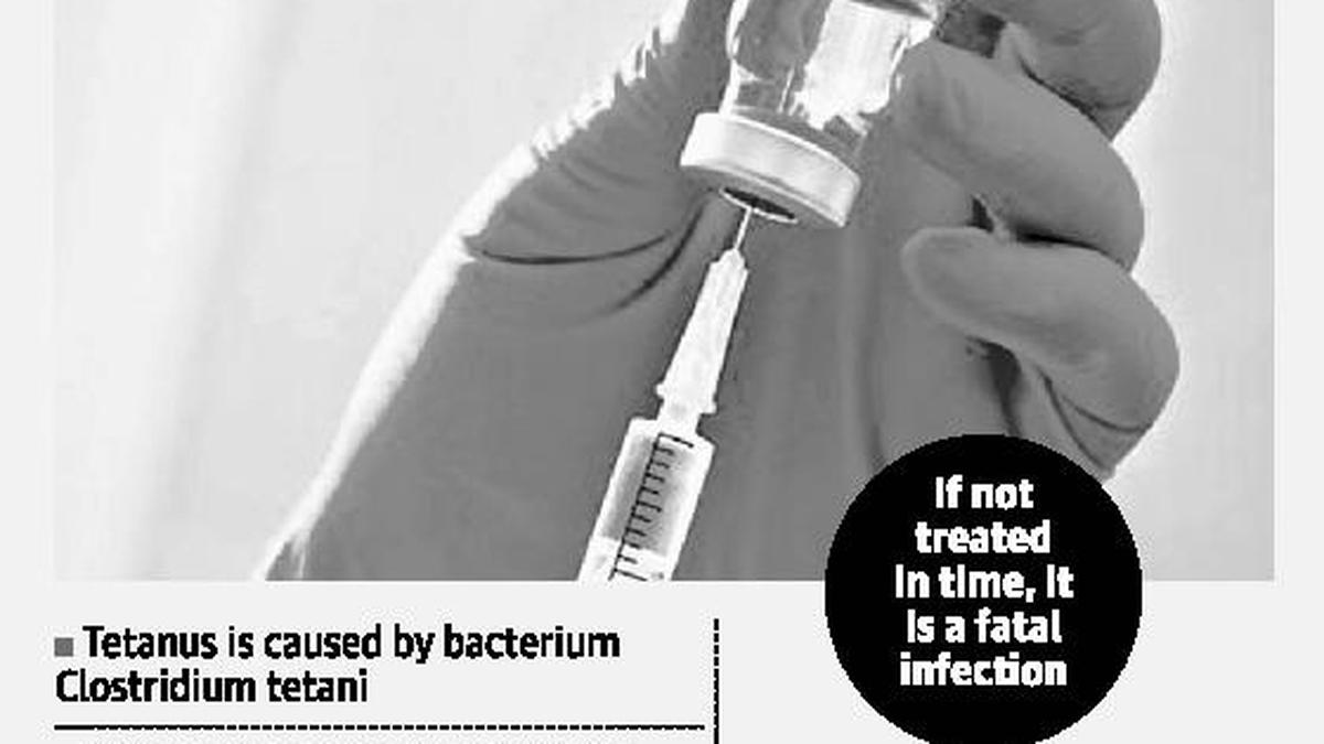 Prevalence of tetanus in State is still a major concern - The Hindu