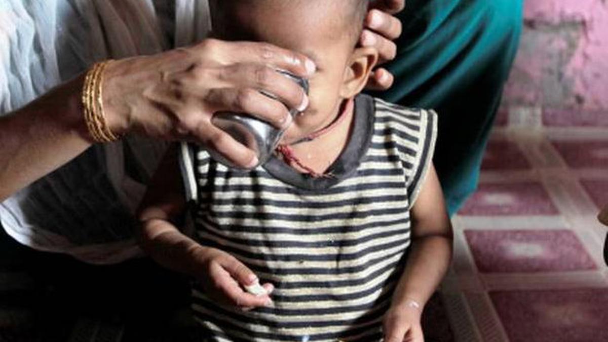 COVID-19 will lead to 6.7 million additional ‘wasted’ children, say ...