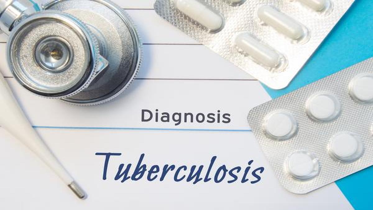 Positive TB test ‘not always cause for worry’ - The Hindu