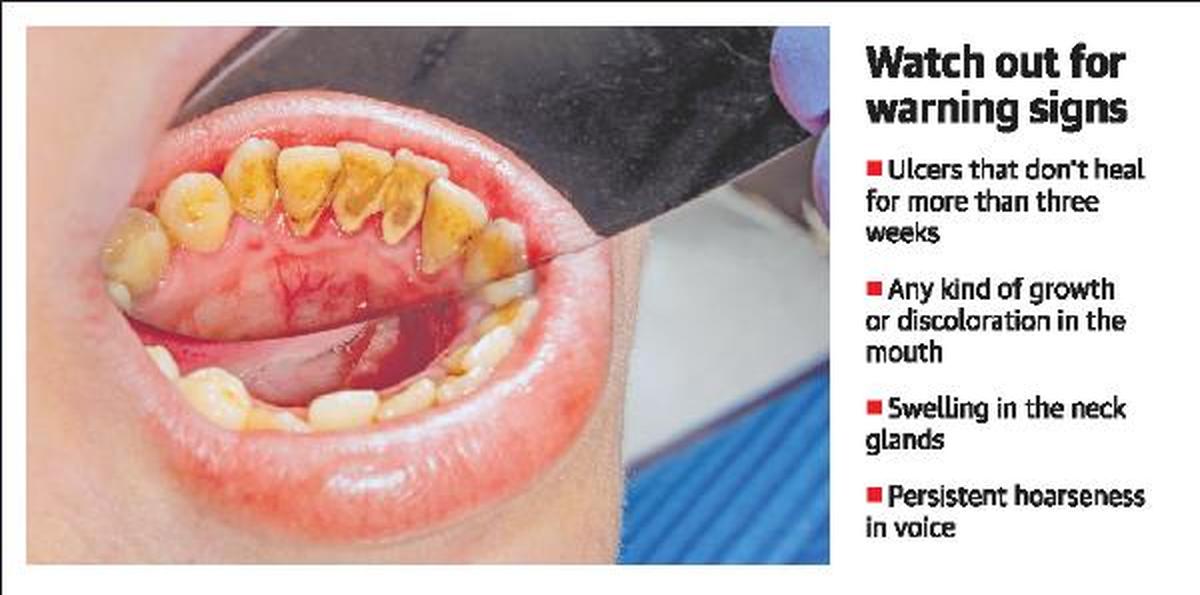 Early Signs Of Gum Cancer From Chewing Tobacco