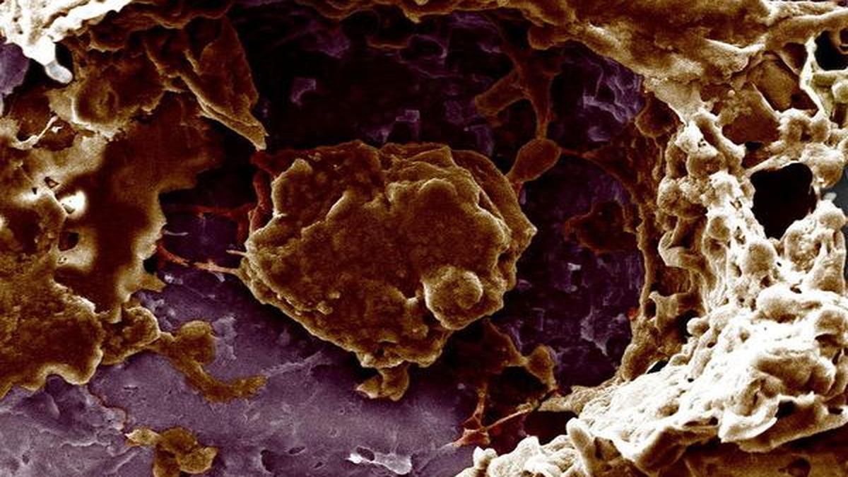 Designing a killer to kill a killer - The Hindu