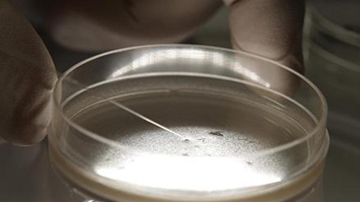 Stem cell shots linked to bacterial infection outbreak - The Hindu