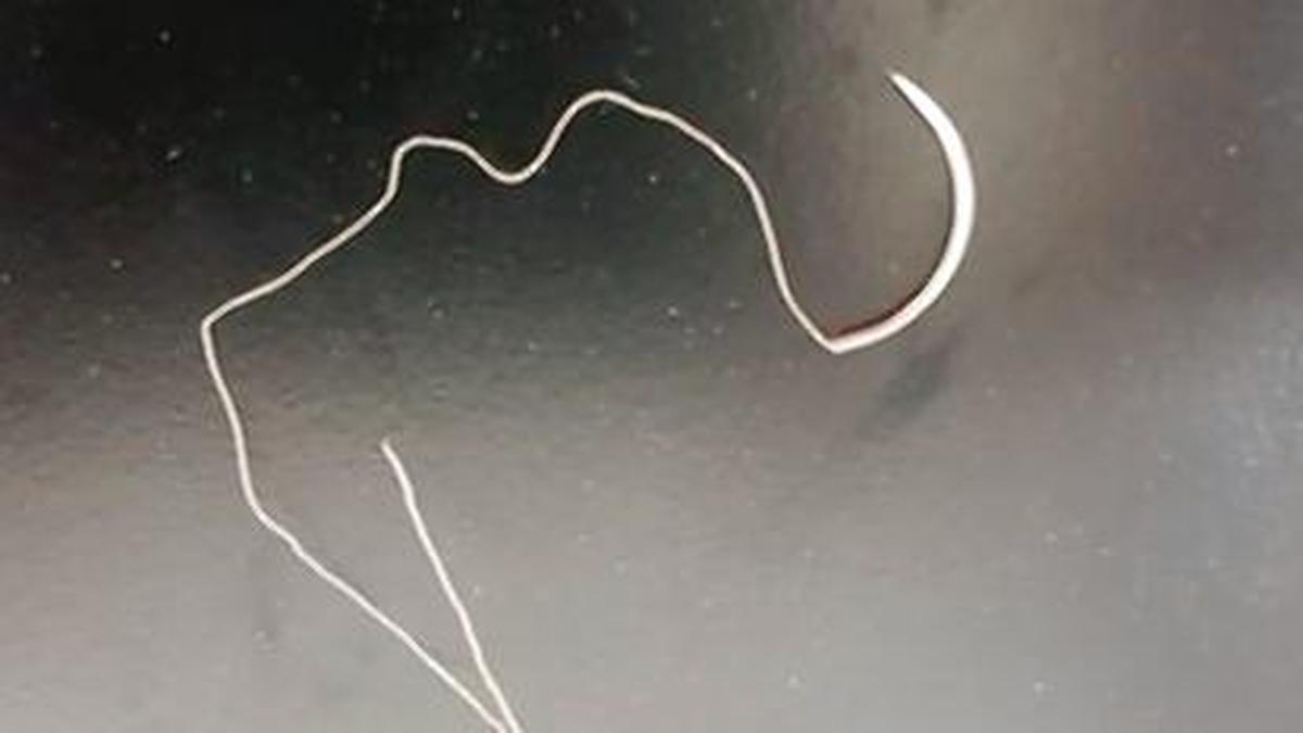 IIT-M team develops sutures with nanofiber yarns - The Hindu