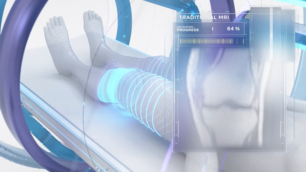 Facebook, NYU use AI to speed up knee MRI scanning process - The Hindu