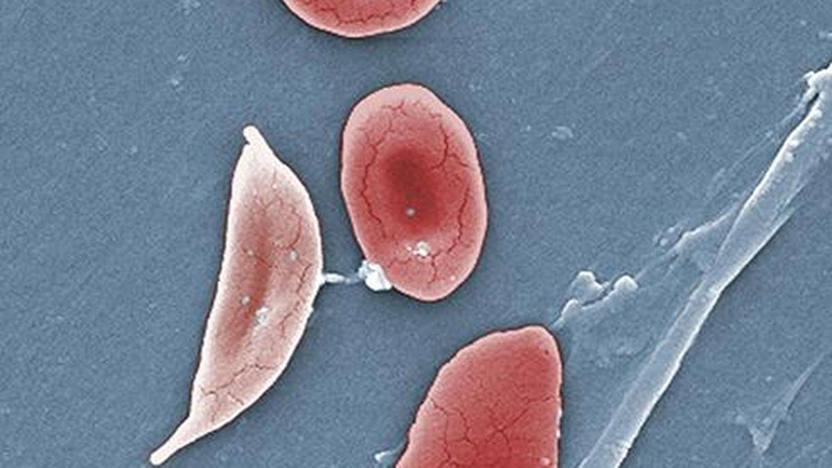 IISc. incubated start-up develops India’s first indigenous diagnostic ...