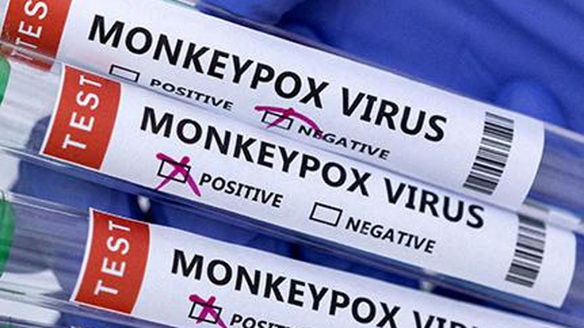 UAE reports three more monkeypox cases - The Hindu