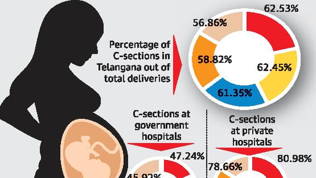 C-section rate drops by nearly 6% in Telangana - The Hindu